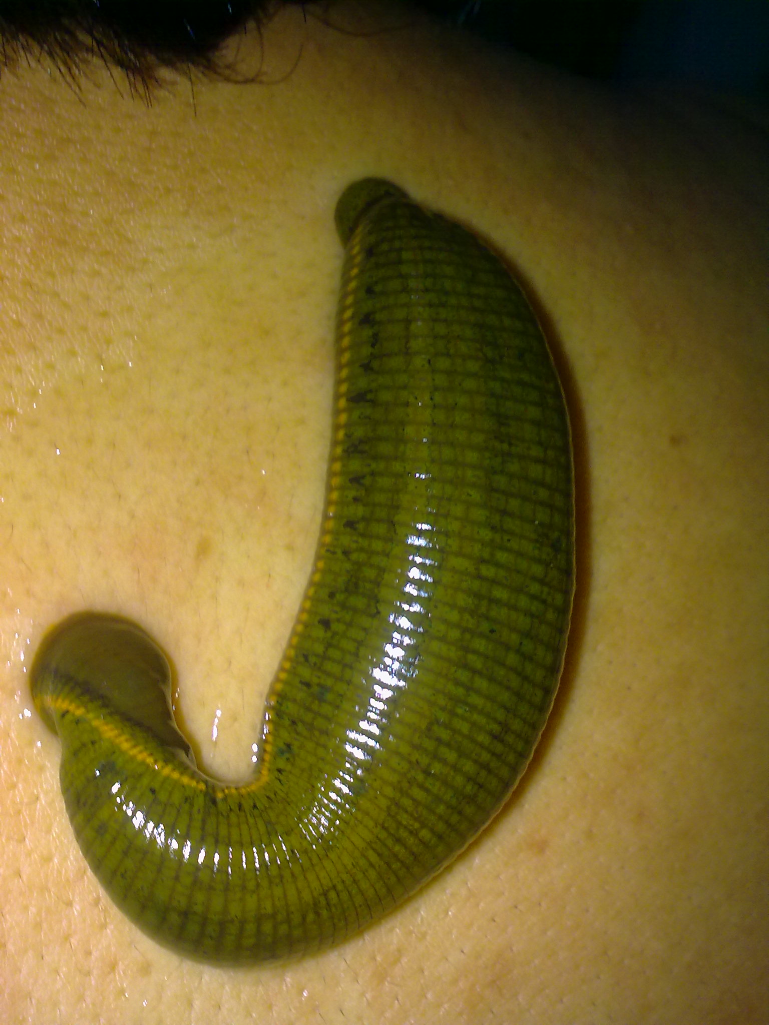 Arti Mimpi Digigit Pacet Di Kaki Menurut Islam