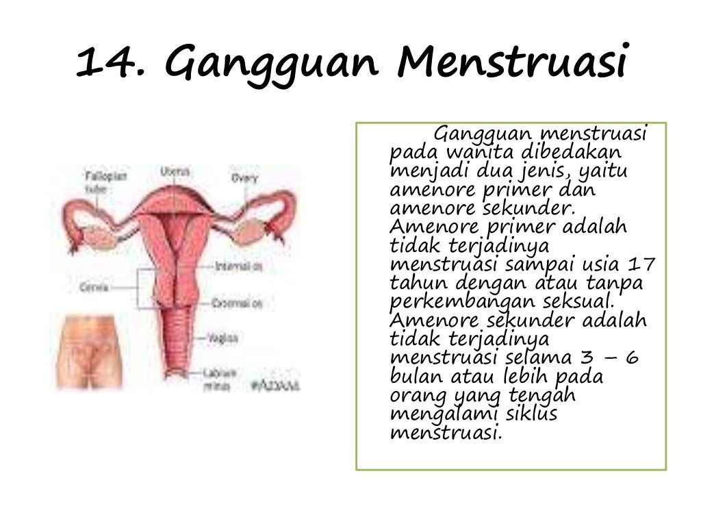 10 Penyakit pada Sistem Reproduksi Manusia dan Penanganannya