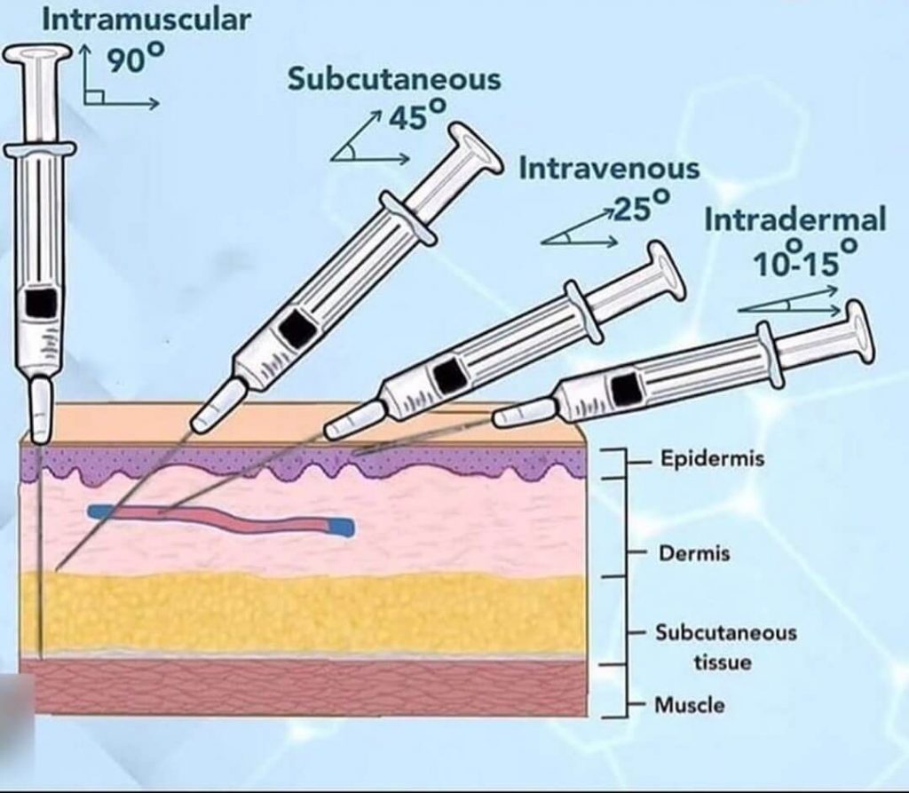 10 Teknik Pemberian Injeksi yang Aman dan Efektif untuk Kesehatan